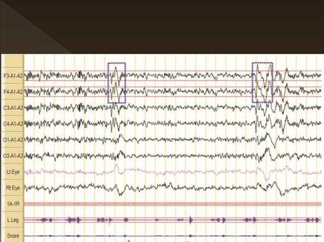 Sleep Scoring New.pptx