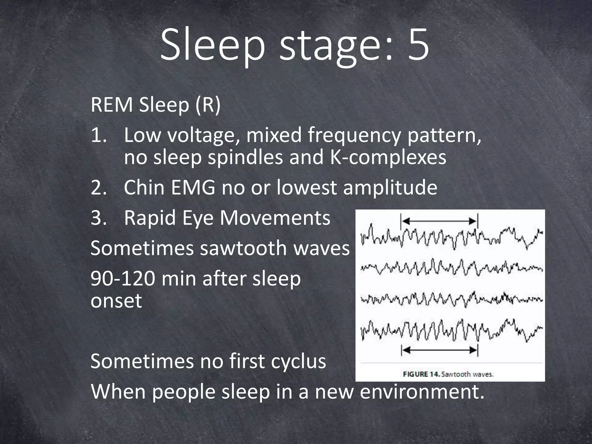 Sleep scoring using AASM | PPTX