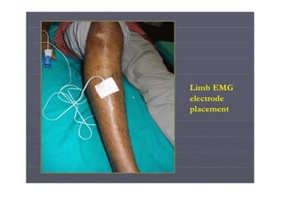 POLYSOMNOGRAPHY & EEG ACTIVATION METHODS | PPTX