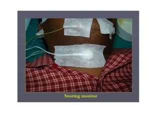 POLYSOMNOGRAPHY & EEG ACTIVATION METHODS | PPTX