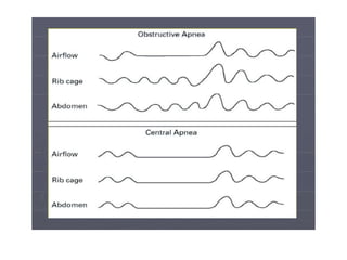 POLYSOMNOGRAPHY & EEG ACTIVATION METHODS | PPTX
