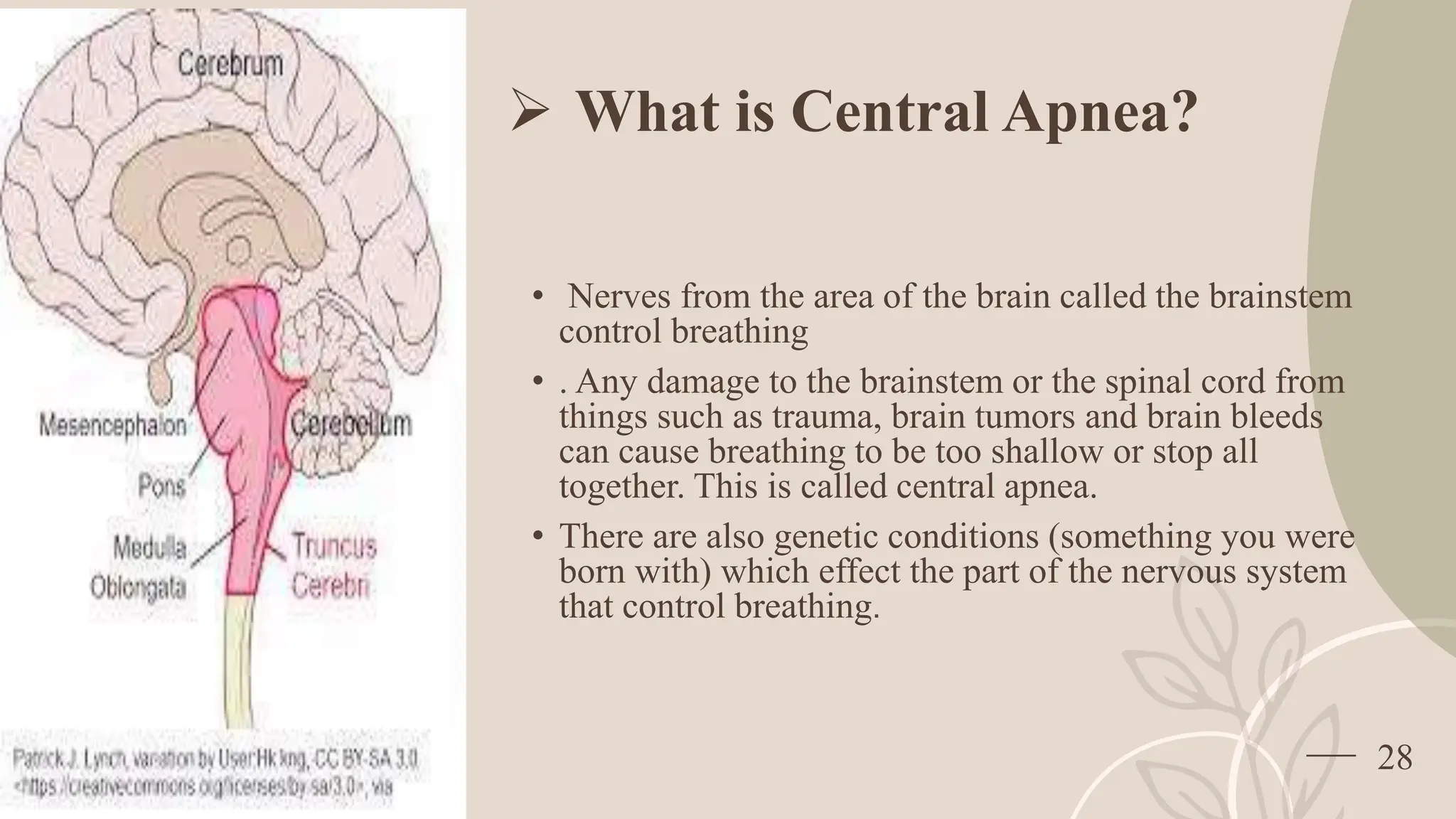 Sleep wake disorder.pptx Sleep wake disorder is a chronic problem ...