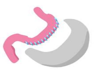 Sleeve gastrectomy education | PPTX