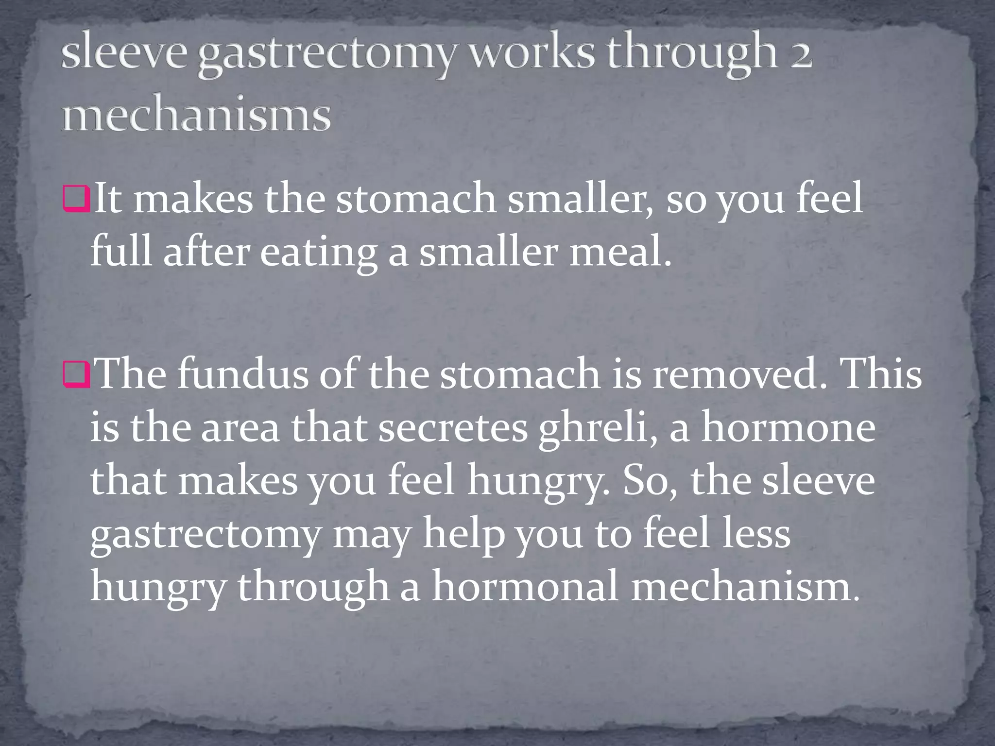 Sleeve gastrectomy surgery | PPTX