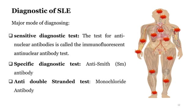 Systemic lupus erythematosus (SLE) disease | PPTX