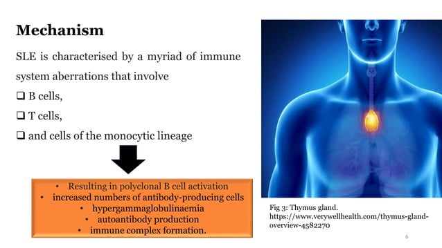 Systemic lupus erythematosus (SLE) disease | PPTX