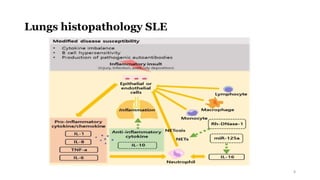 Systemic lupus erythematosus (SLE) disease | PPTX
