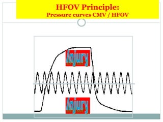 SLE 5000 HFOV Dr.ALLAM ABUHAMDA CONSULTANT NEONATOLOGIST | PPTX