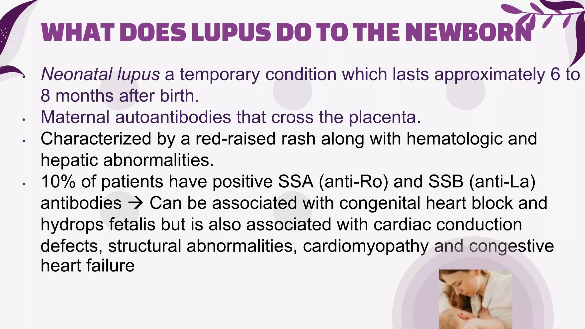 sle in pregnancy yoel.pptx