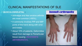 SLE PRESENTATION presentatiomn (1).pptx