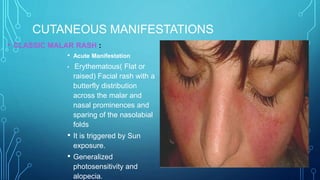 SLE PRESENTATION presentatiomn (1).pptx