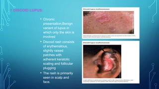 SLE PRESENTATION presentatiomn (1).pptx