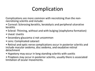 SLERITIS in detail including anterior and posterior | PPT