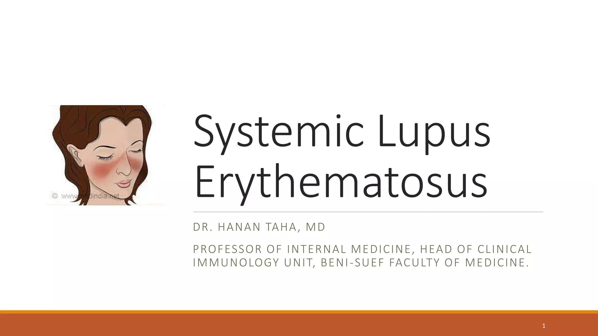 SLE Systemic lupus erythematosus basics 2022 Prof. Hanan Ali Taha | PPTX