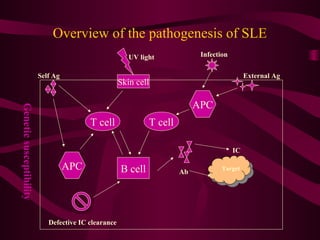systemic lupus erythematosus | PPT