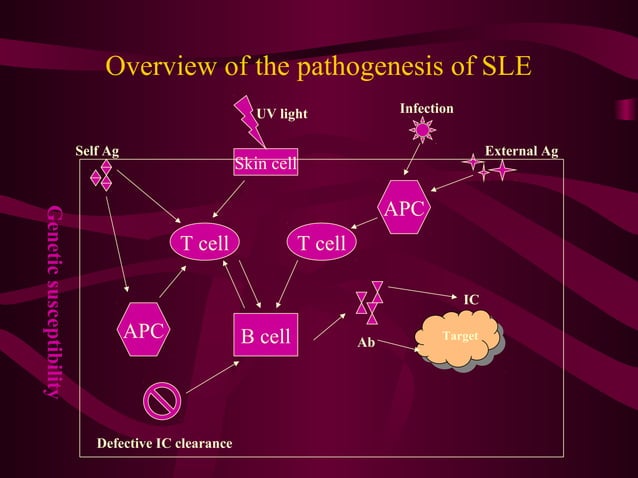 systemic lupus erythematosus | PPT