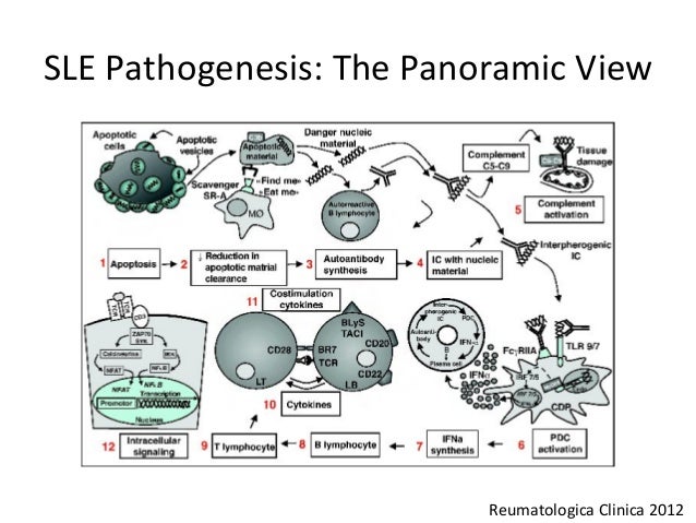 Sle What Lies Beneath