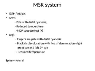 Systemic lupus erythematosus with Vasculitis.pptx