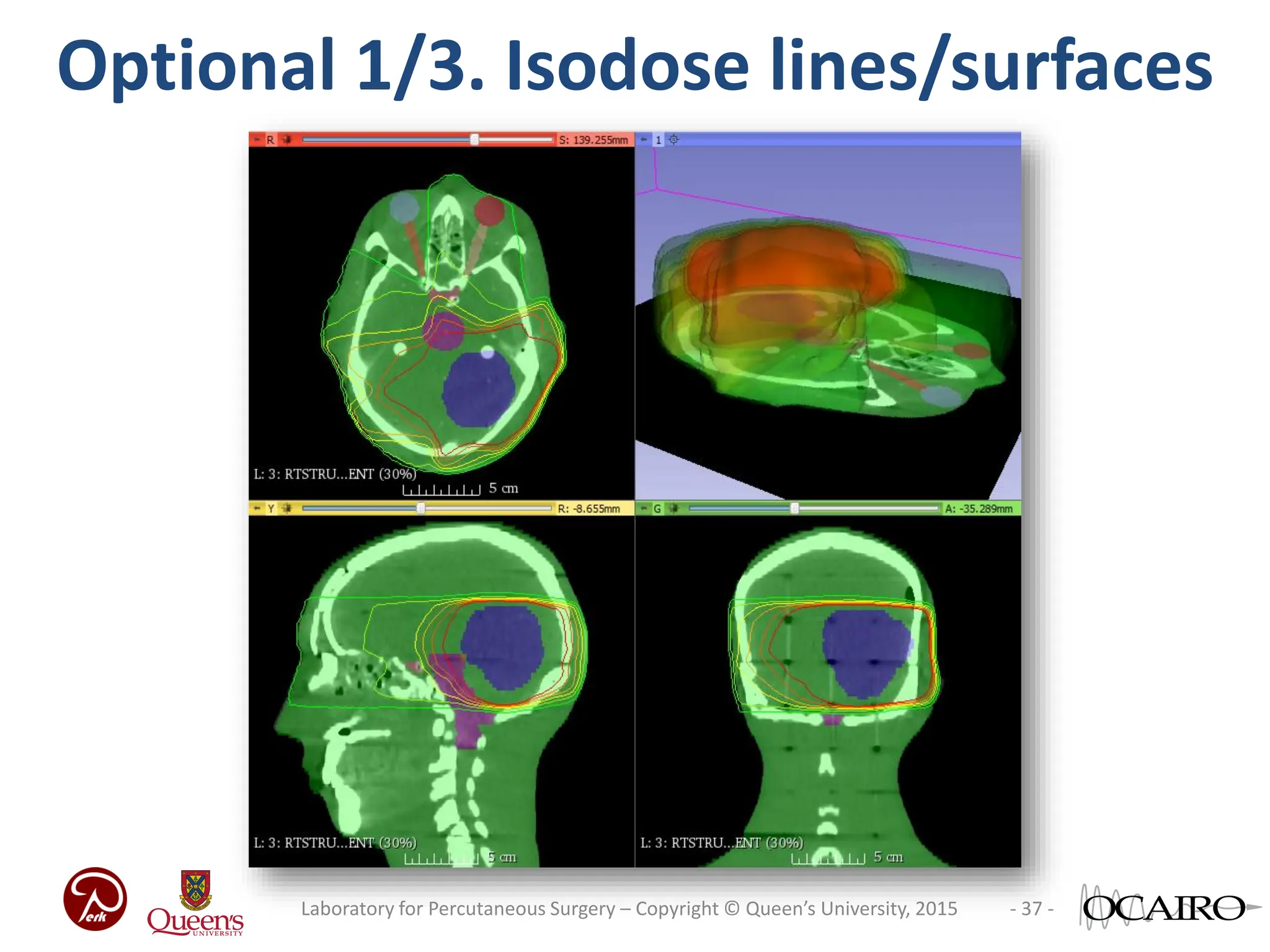 SlicerRT World Congress Tutorial IGRT SLICER | PDF