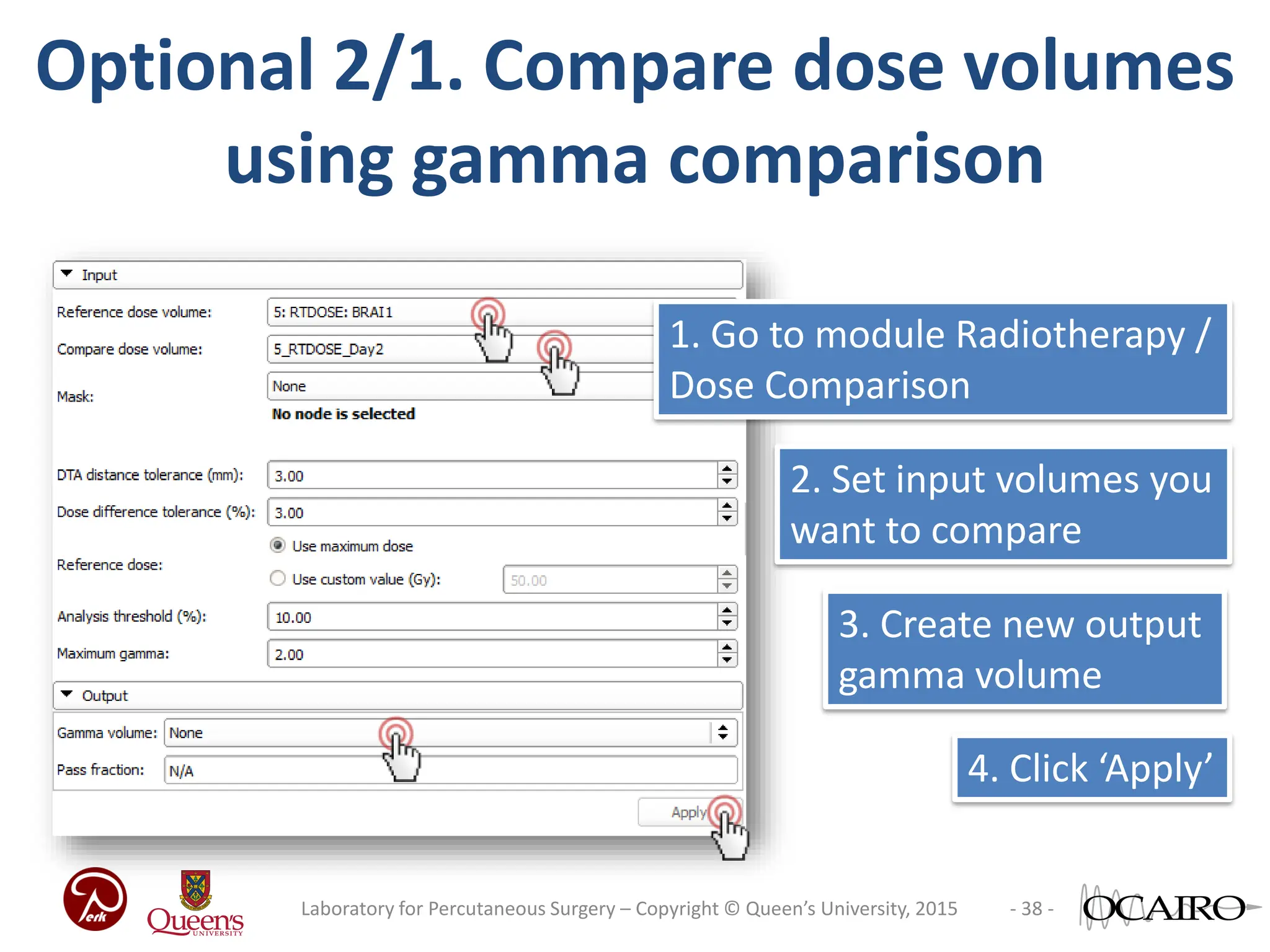 SlicerRT World Congress Tutorial IGRT SLICER | PDF