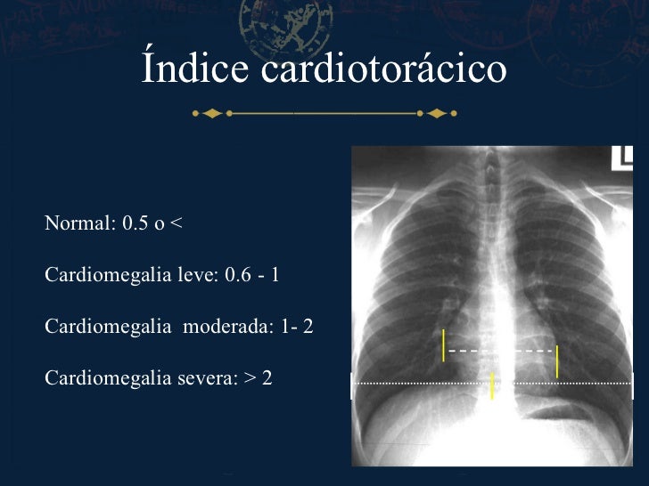 Anatomía del tórax por radiografía simple