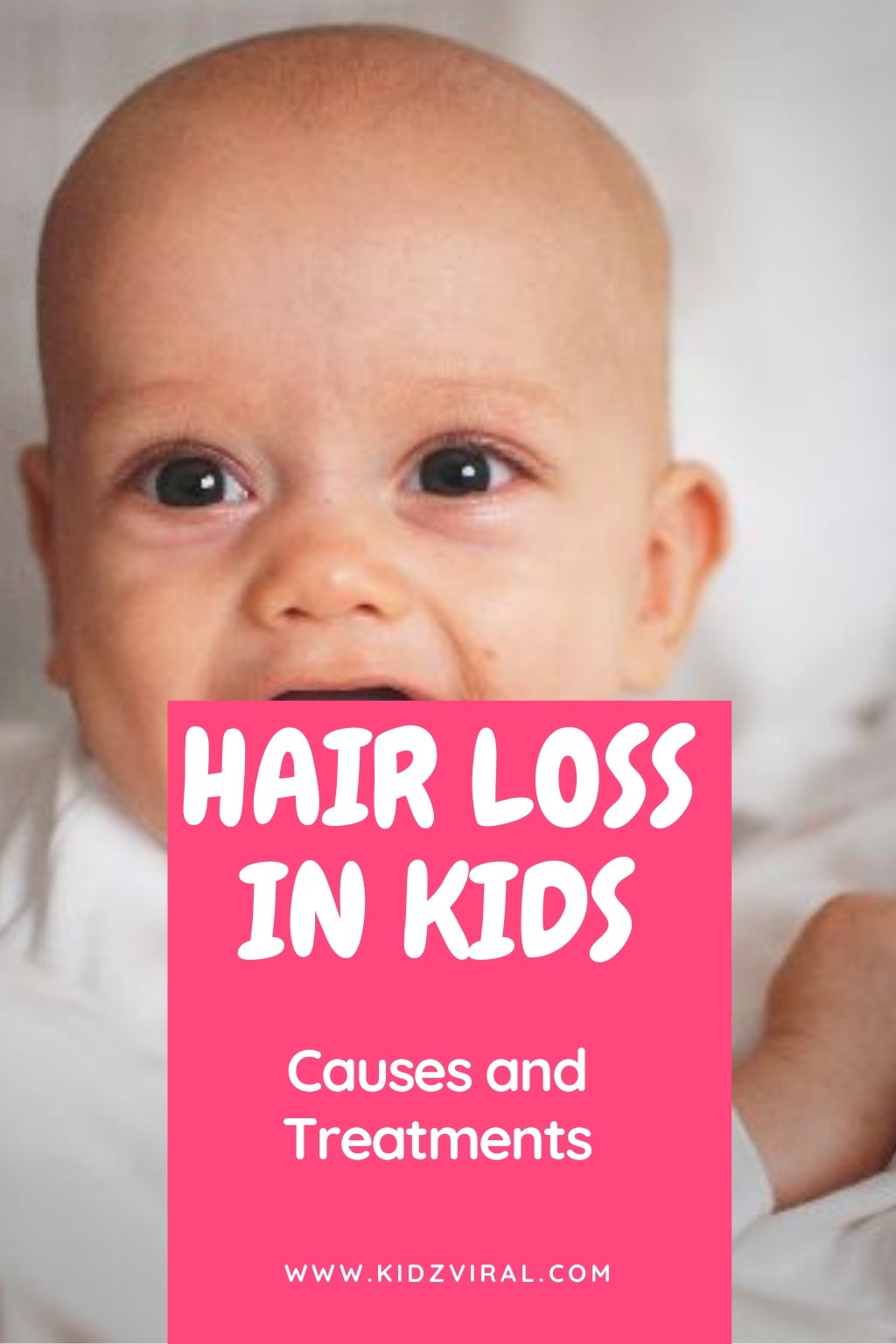 Hair Loss In Children When To Worry Causes And Treatments hair-loss-in-children-when-to-worry-causes-and-treatments