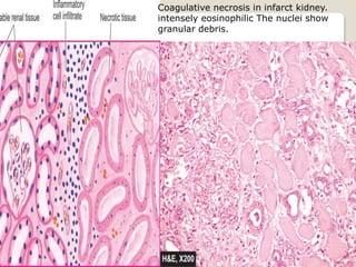 Kidney Slide