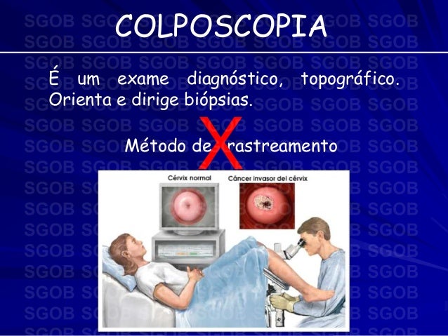 Slide aspectos clinicos da-colposcopia