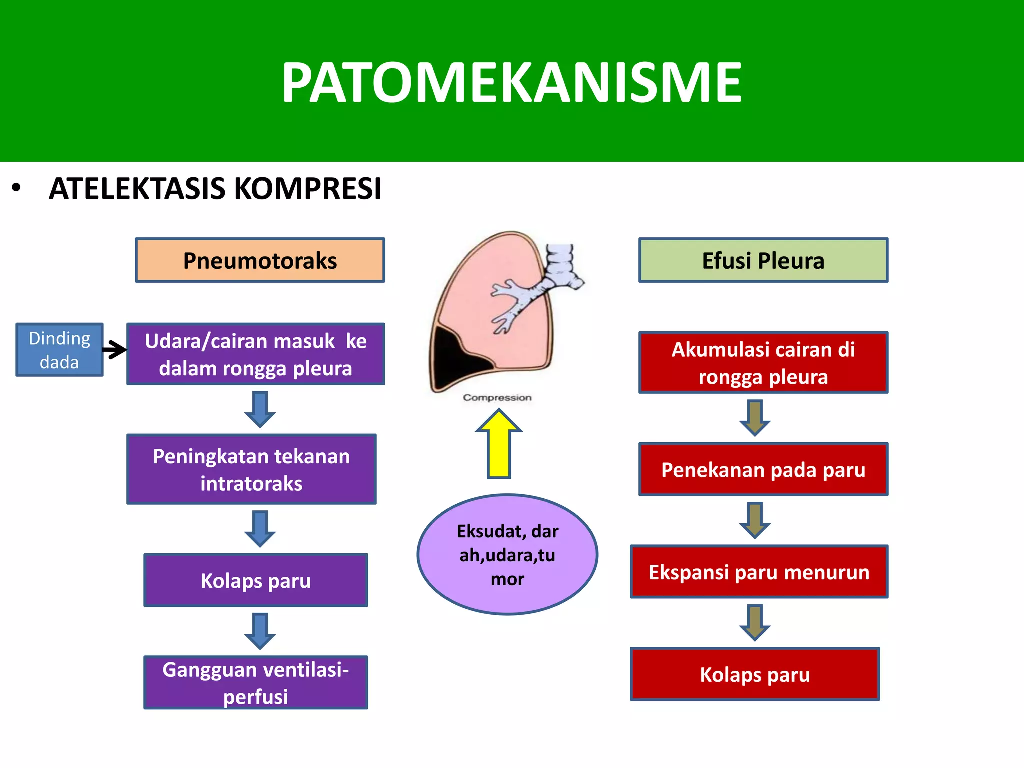 Slide atelektasis paru | PPTX