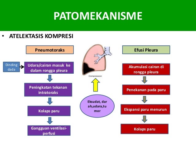 Slide atelektasis paru