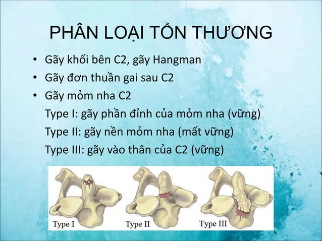 Slide CTCS cổ cao 1.pptx