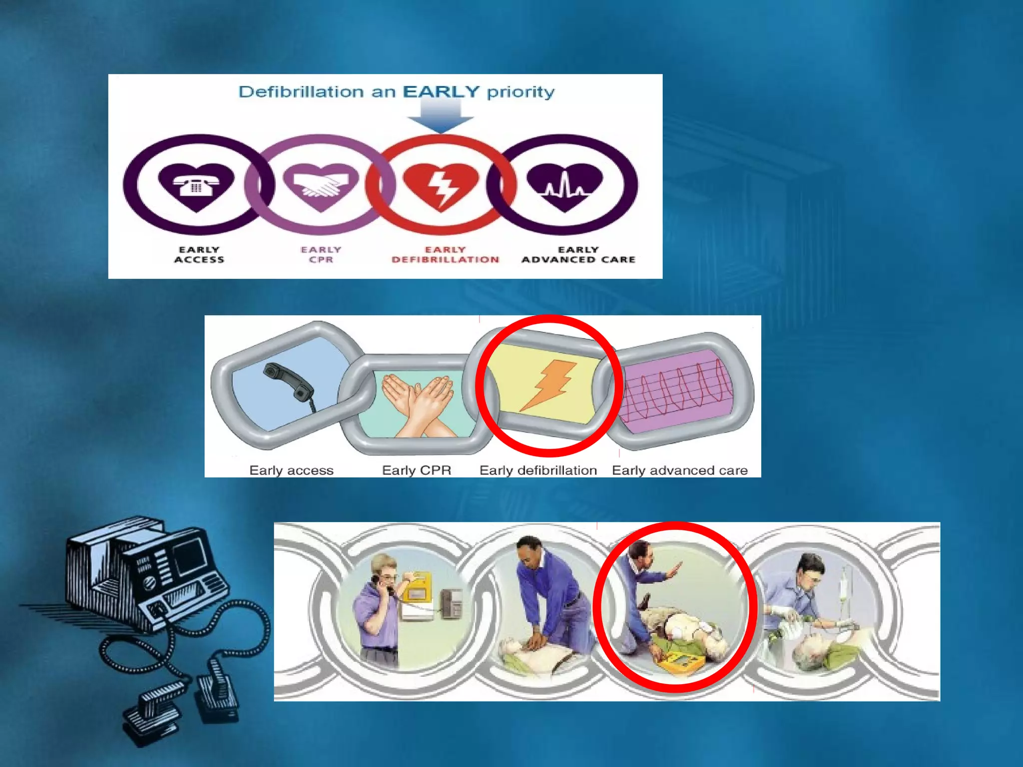 Slide defibrilator | PPT