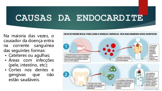 O que é, e o que causa a Endocardite.