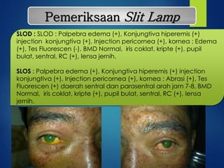 Slide fikar trauma kimia | PPTX