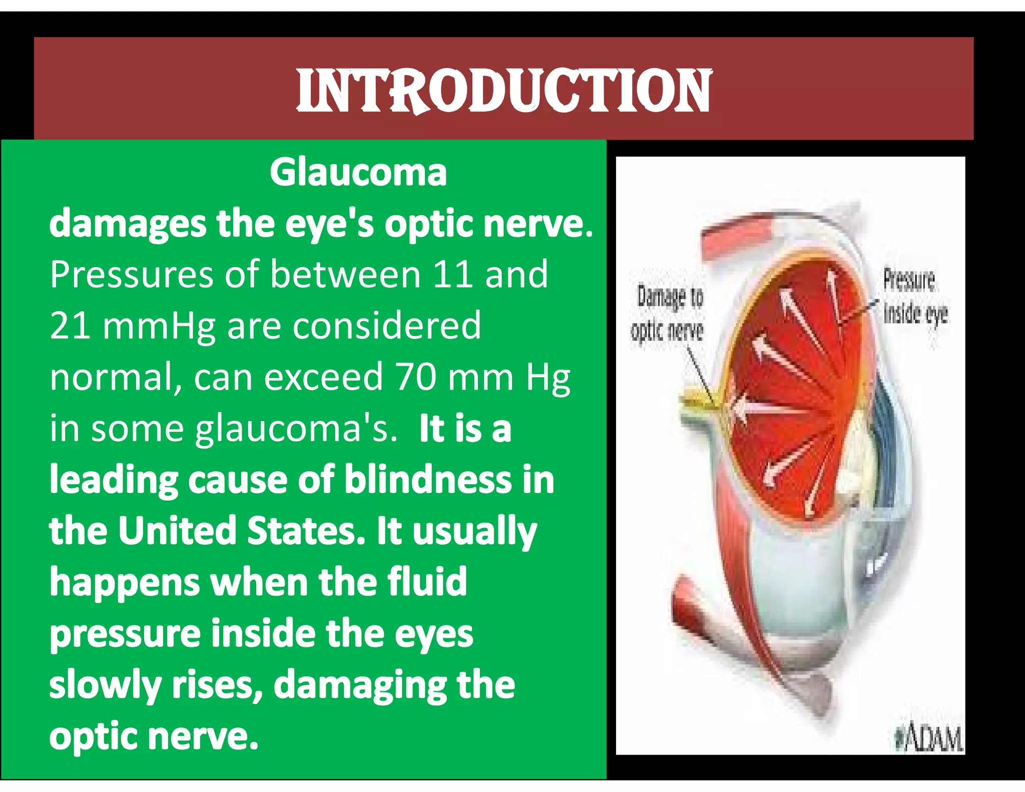 slide for glaucoma.pdf