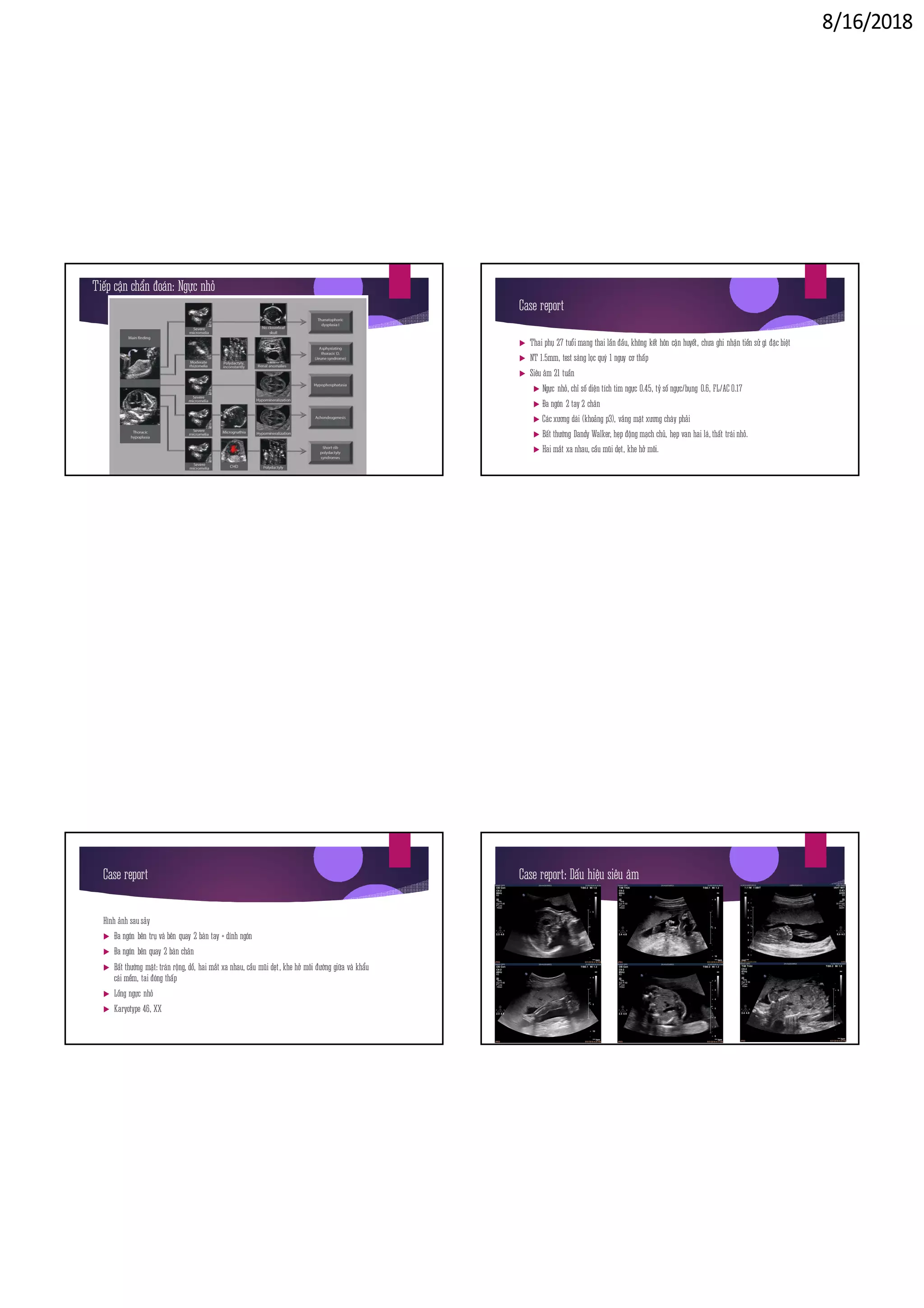 Case report: Short rib polydactyly syndrome type II - Majewski syndrome ...