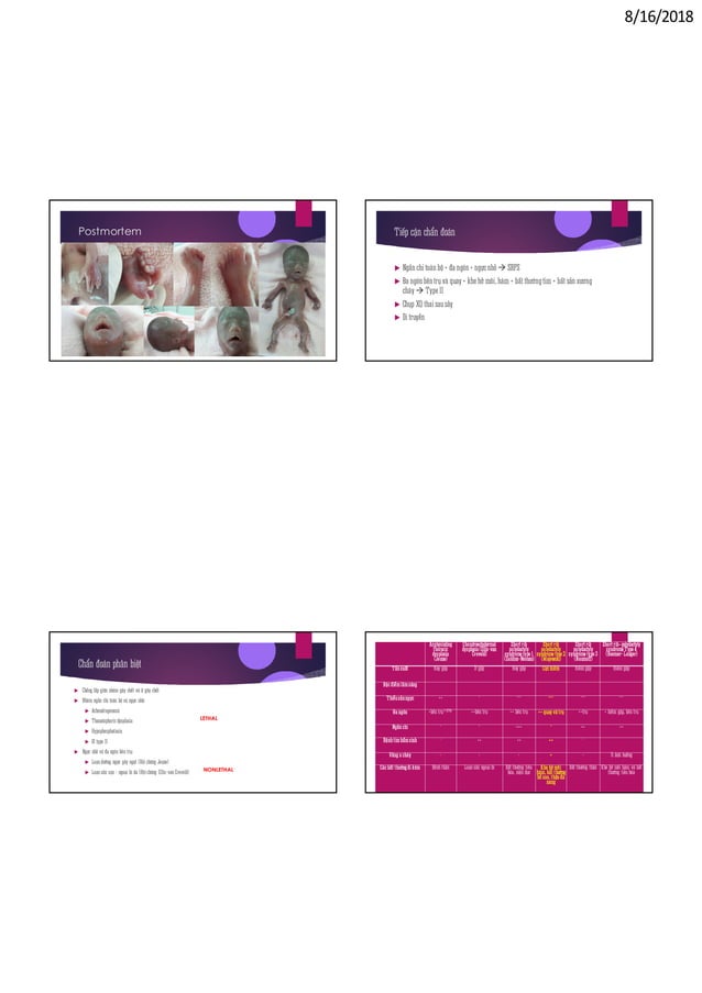 Case report: Short rib polydactyly syndrome type II - Majewski syndrome ...