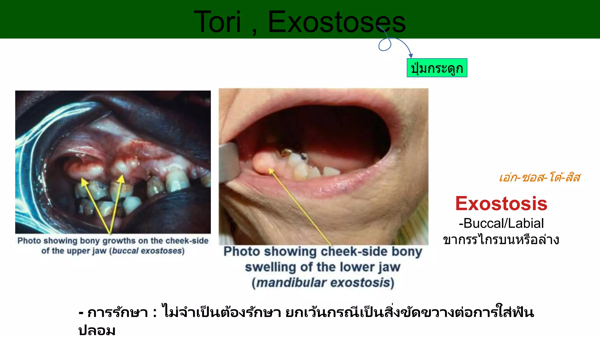 Normal variation | PPTX