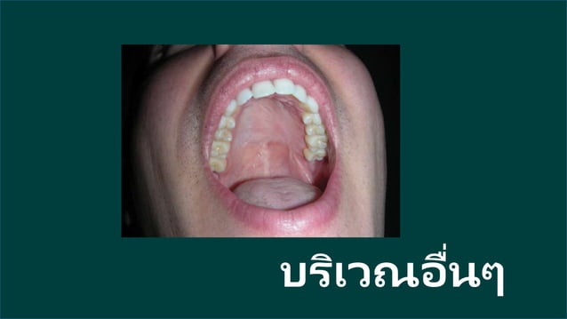 Normal variation | PPTX