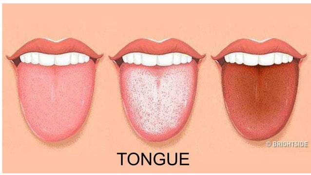 Normal variation | PPTX