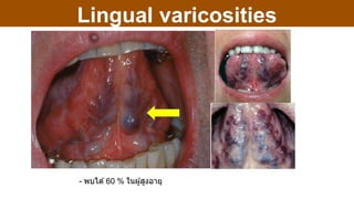Normal variation | PPTX