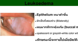 Normal variation | PPTX