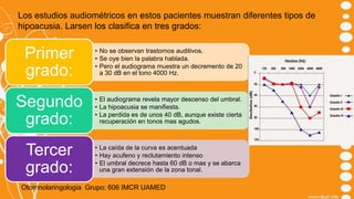 Hipoacusia inducida por ruido | PPTX