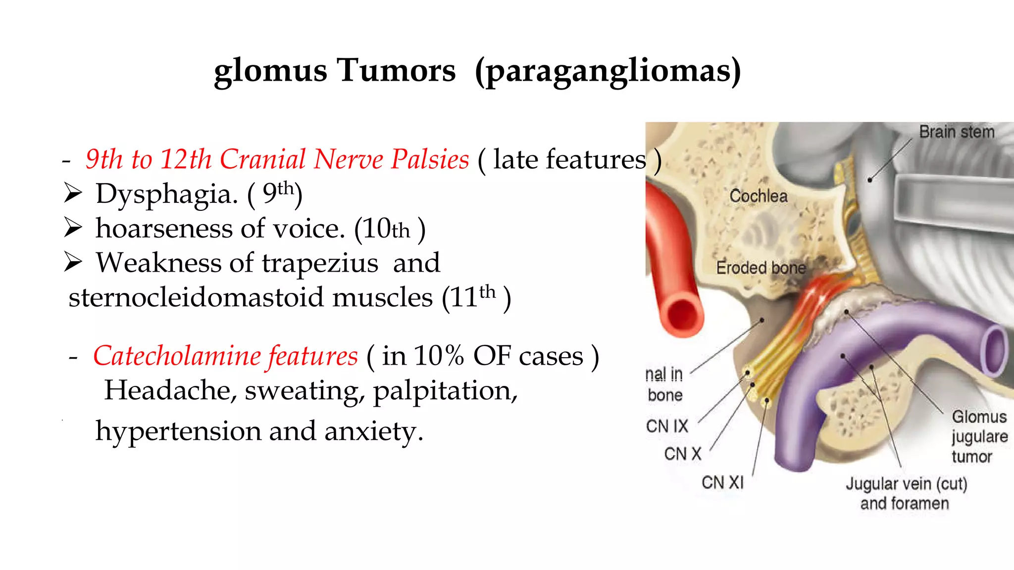 common middle ear tumors | PDF