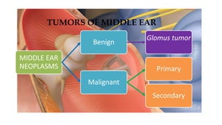 common middle ear tumors | PDF