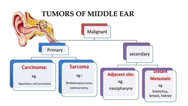 common middle ear tumors | PDF