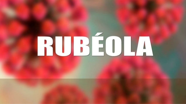 Rubeóla