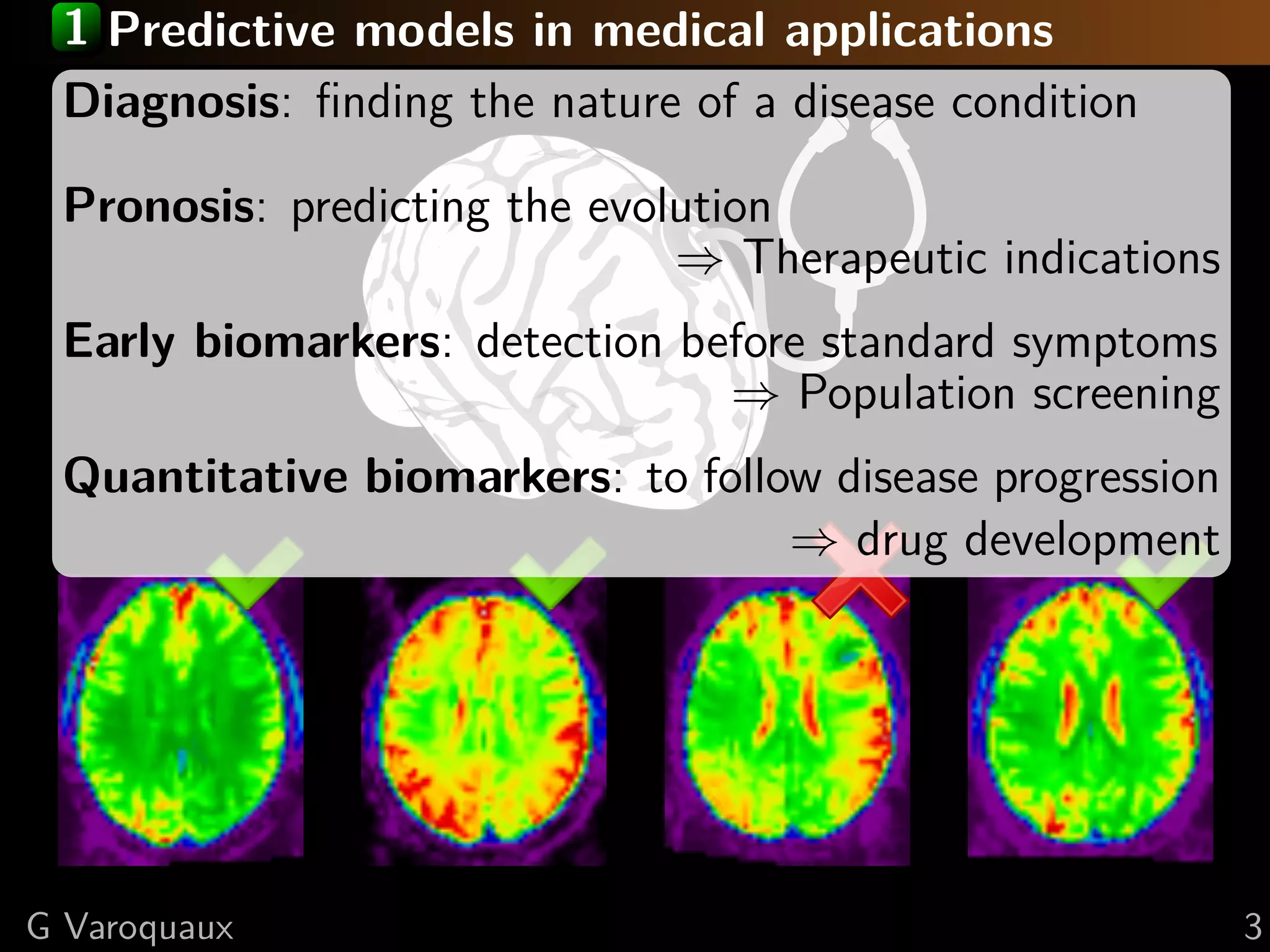 Scikit-learn and nilearn: Democratisation of machine learning for brain ...