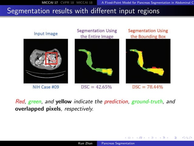 Pancreas Segmentation | PPT