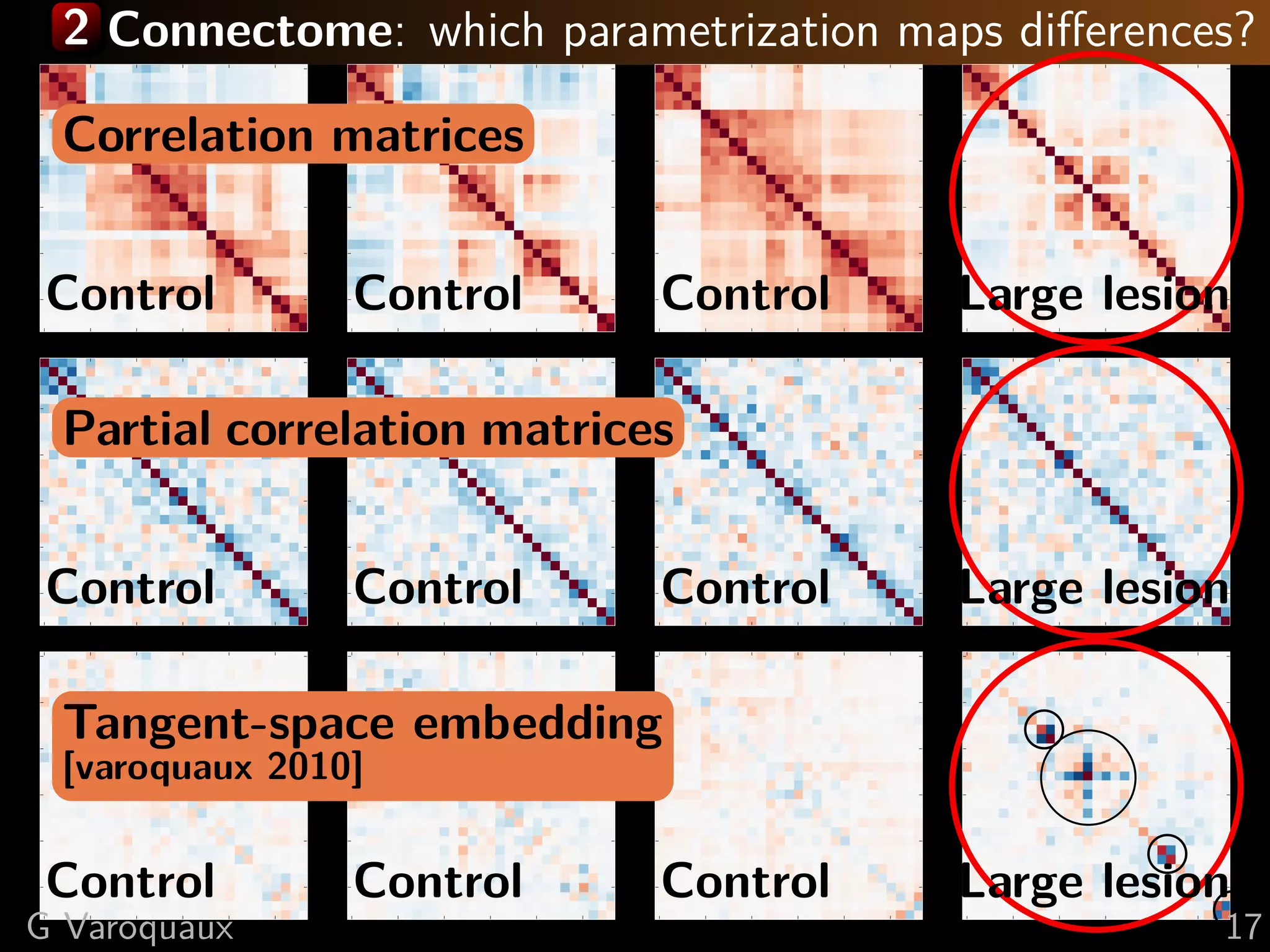 Machine learning for functional connectomes | PPT